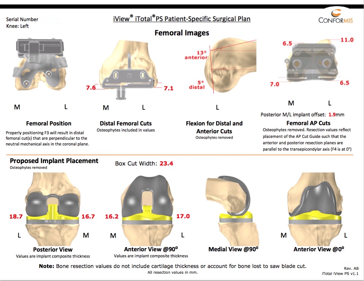 Custom made Knee Replacements Knee Replacements In London Custom made Knee Replacements Knee Replacements In London